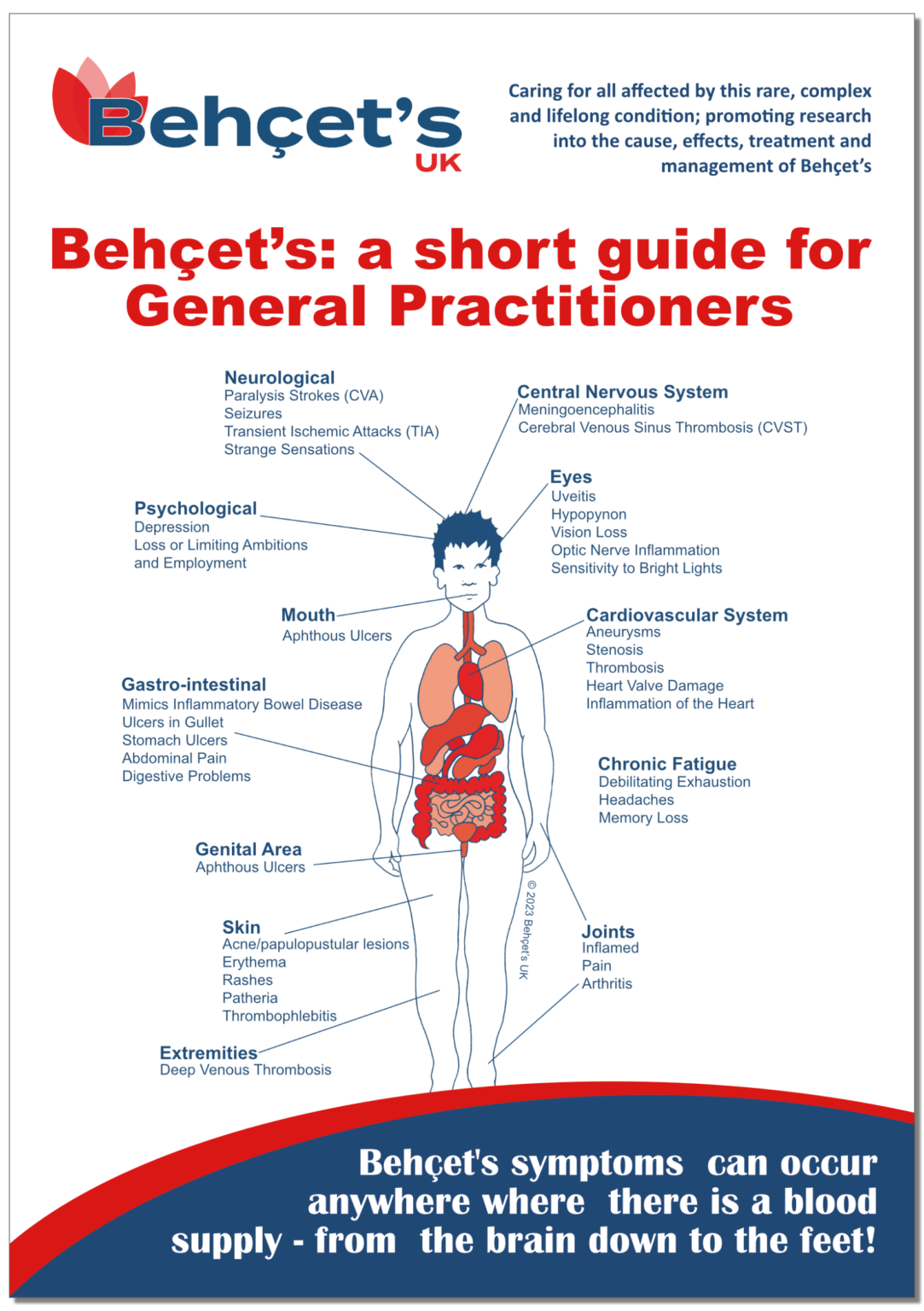 Behçet’s UK Medical Factsheets