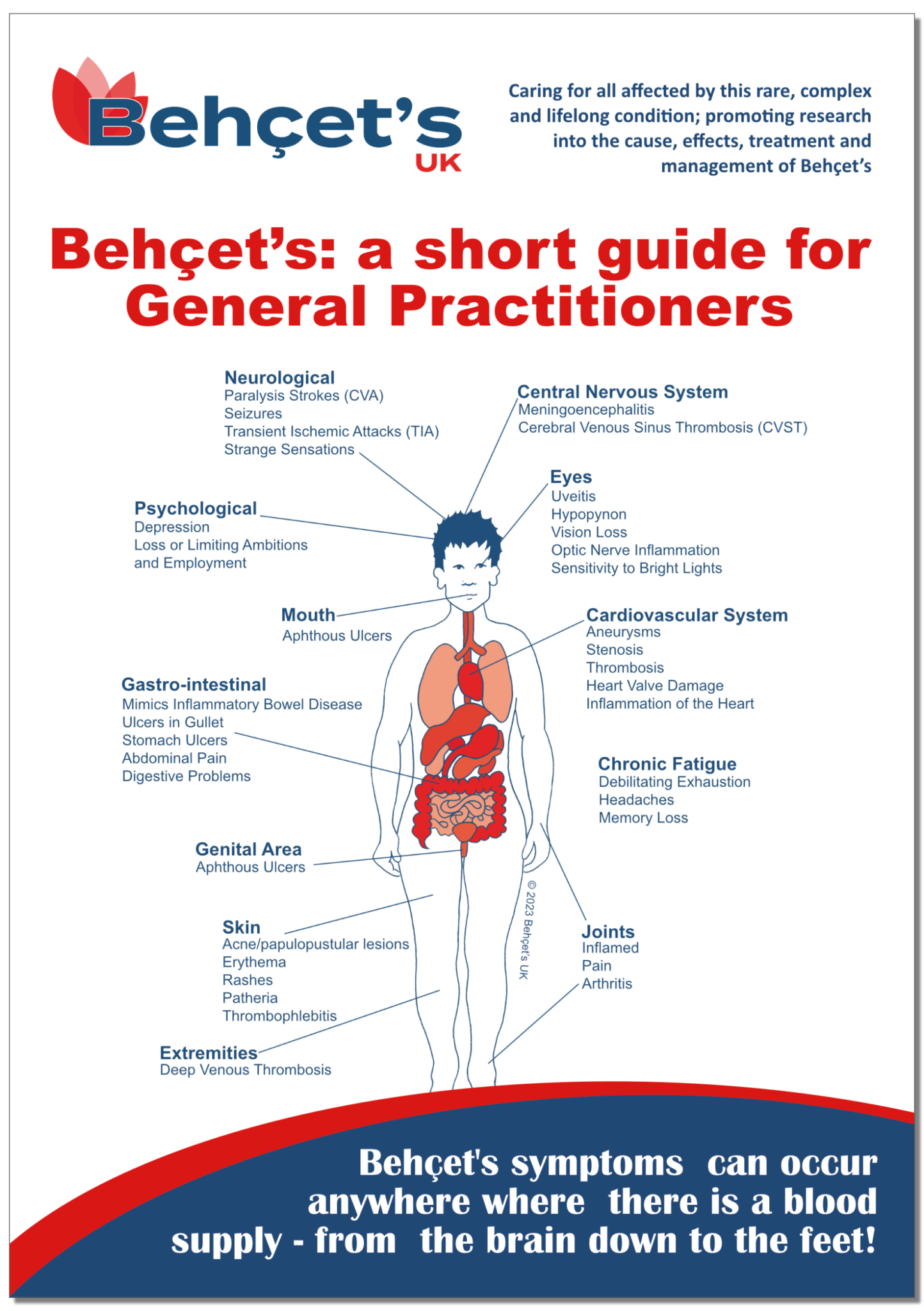 Behçet’s UK Medical Factsheets