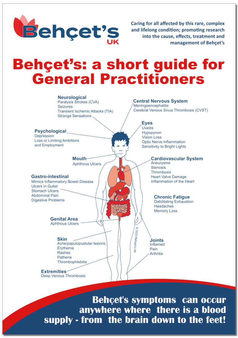 Behçet’s UK Medical Factsheets